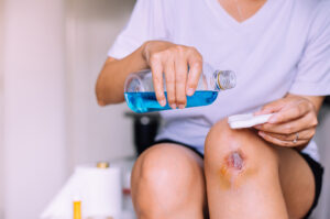 What To Do When Your Wound Gets Infected | Renew Wound